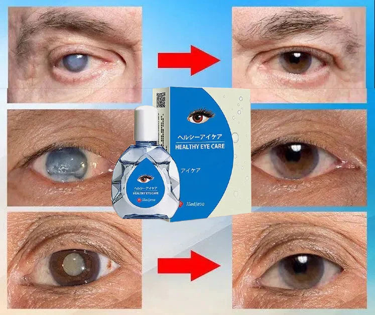 Japan Vision Drops — Rapidly Heals All Eye Conditions & Restores Vision ...